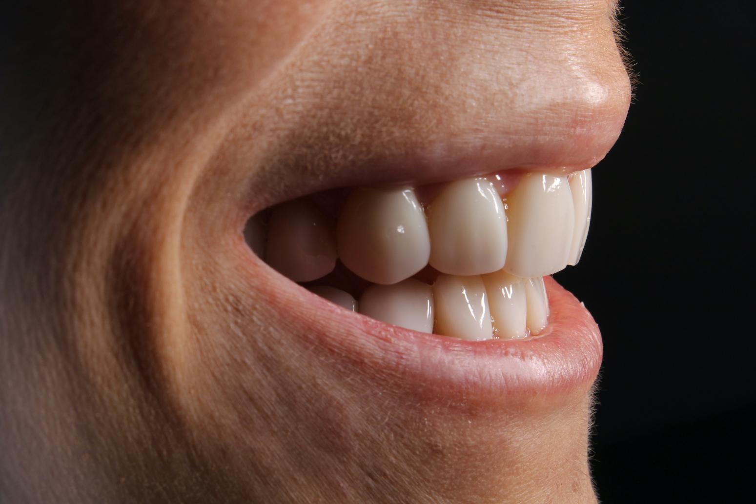 Digital Smile Design: cos'è, come funziona